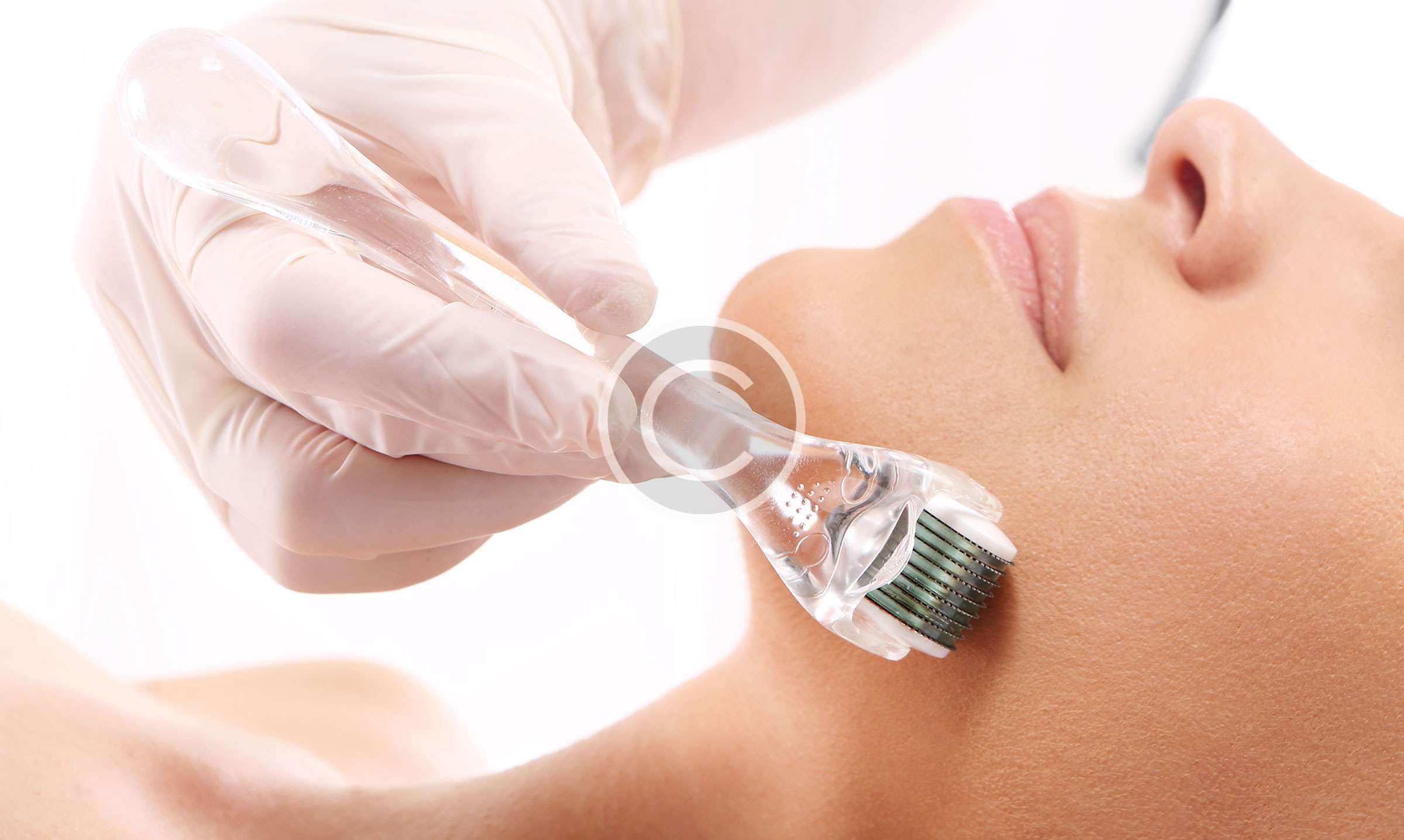 Mesotherapy - Sterizar